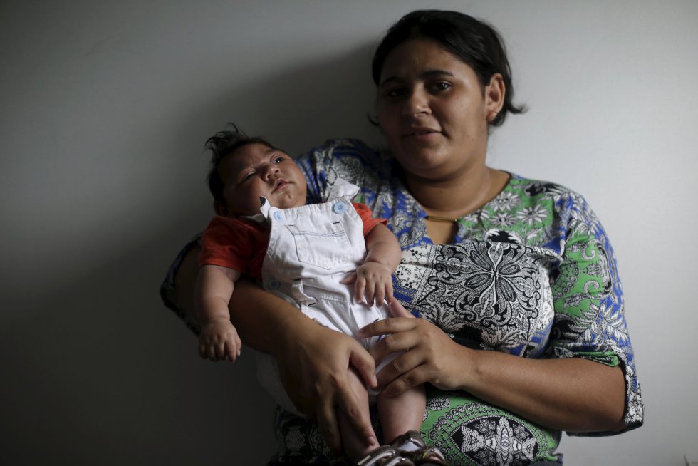 Fotos: Los nacidos con microcefalia en Campina Grande, Brasil ...