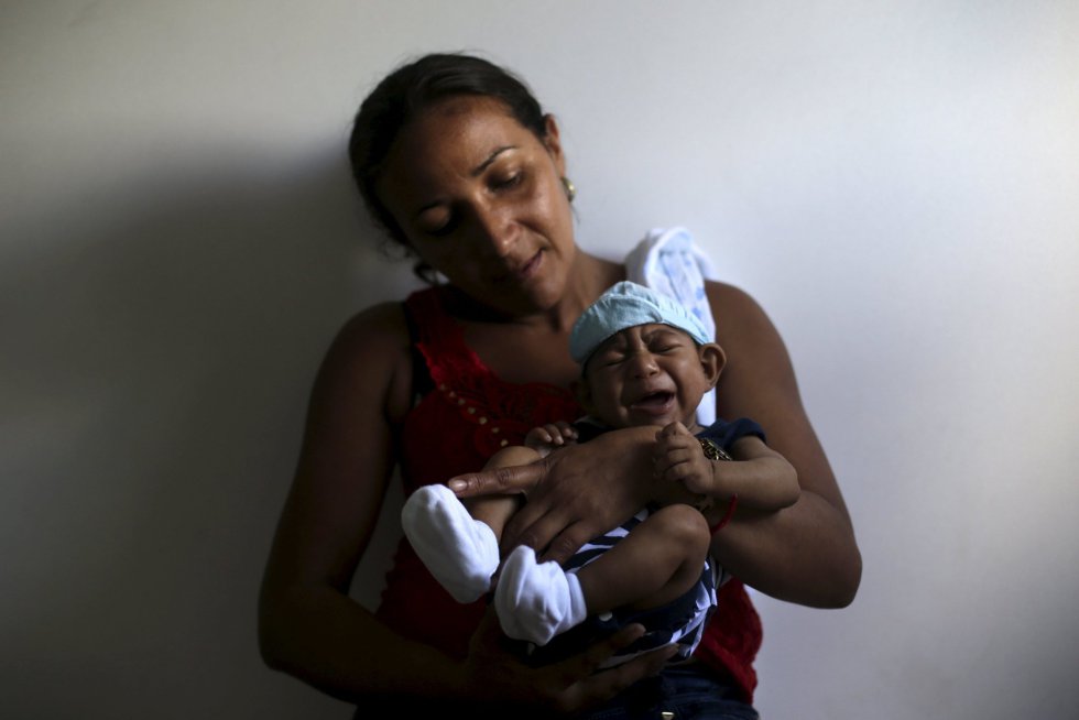 Fotos: Los nacidos con microcefalia en Campina Grande, Brasil ...