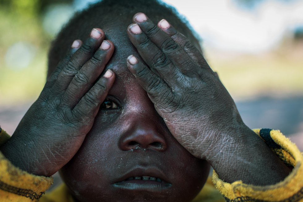 Fotos: Mopeia se prepara para plantar cara a la malaria | Planeta ...